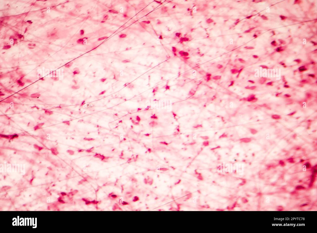 Human loose connective tissue, light photomicrograph, hematoxylin and ...