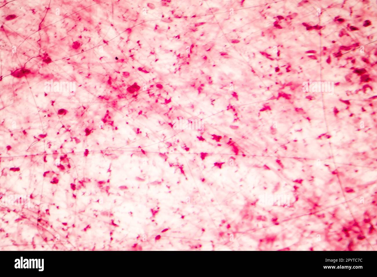 Human loose connective tissue, light photomicrograph, hematoxylin and ...