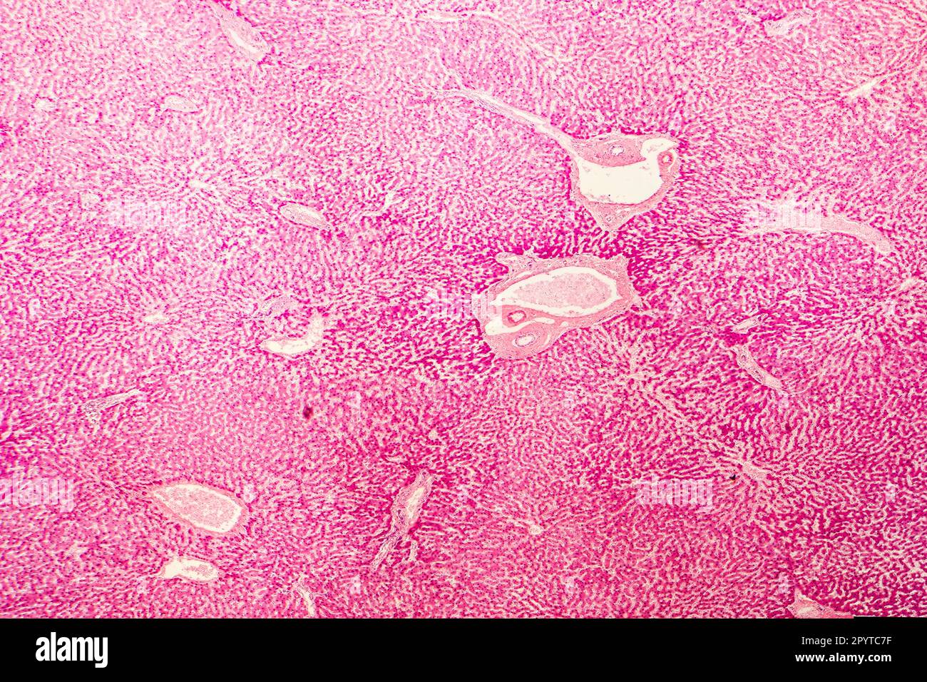 Human liver, photomicrograph showing cords made from hepatocytes and ... Human liver, photomicrograph showing cords made from hepatocytes and ...