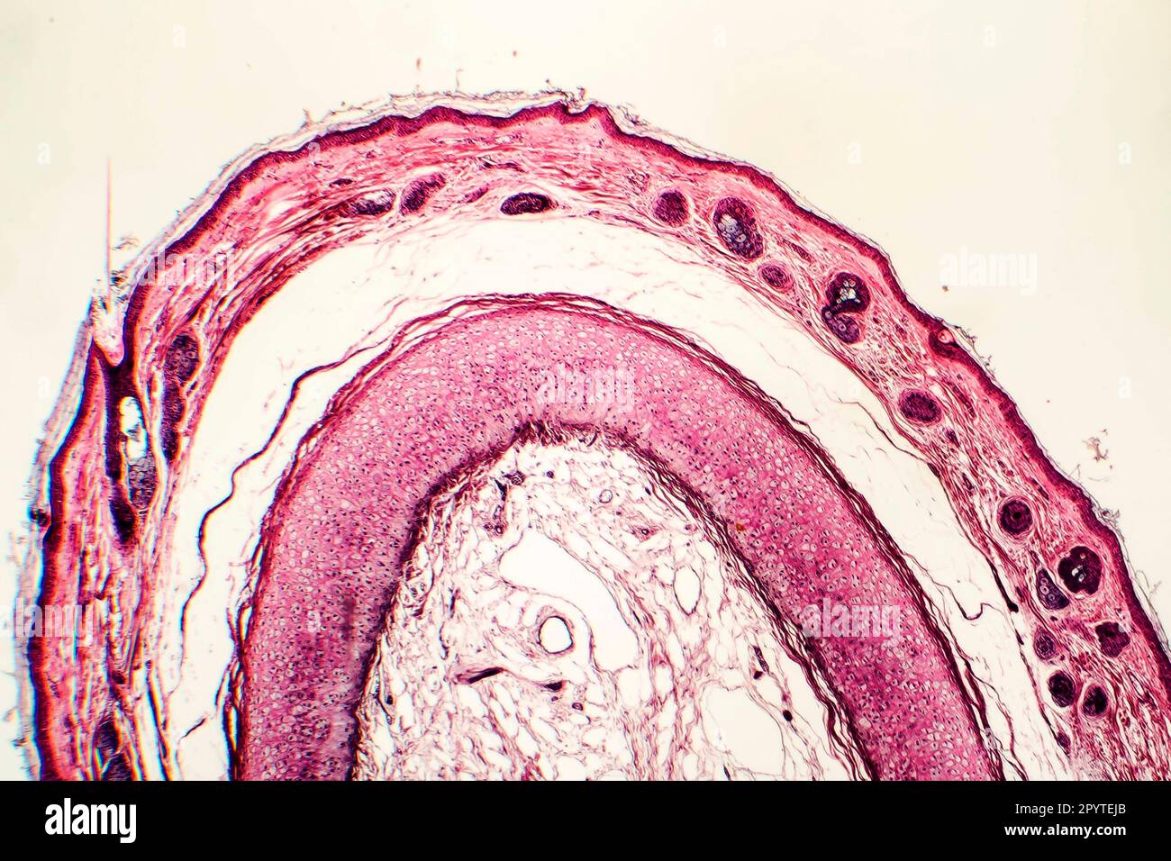 Elastic cartilage of human outer ear, light micrograph Stock Photo - Alamy