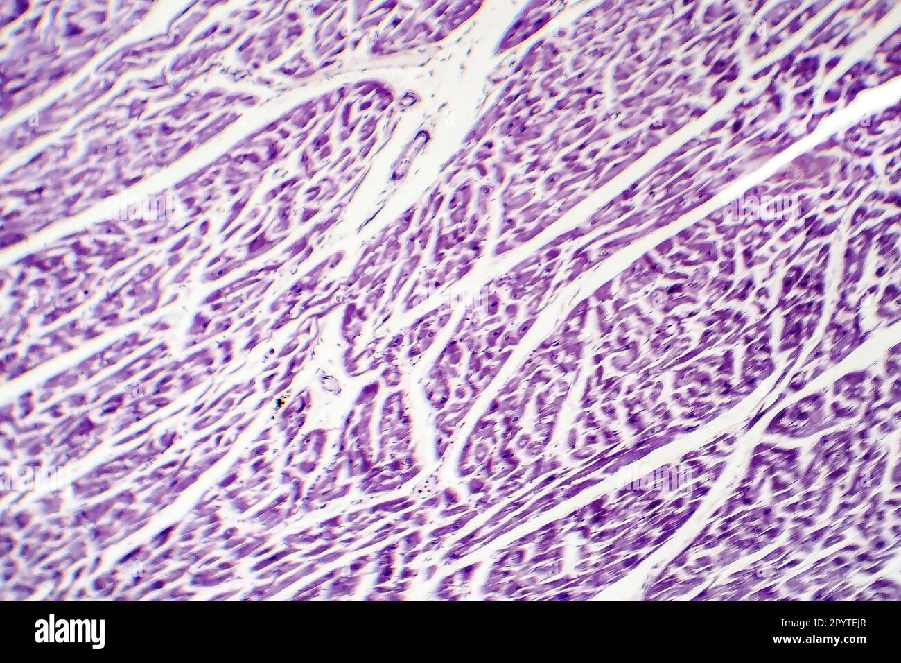 Human heart muscle, light micrograph. Striated cardiac muscle cells, or ...