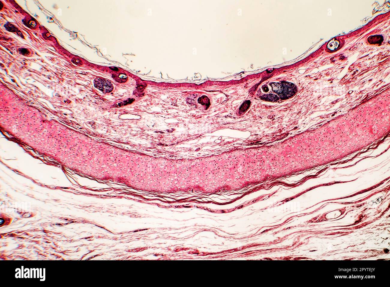 Elastic cartilage of human outer ear, light micrograph Stock Photo - Alamy