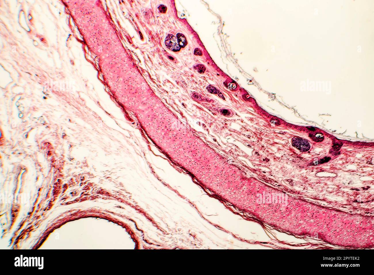 Ear Cartilage Histology