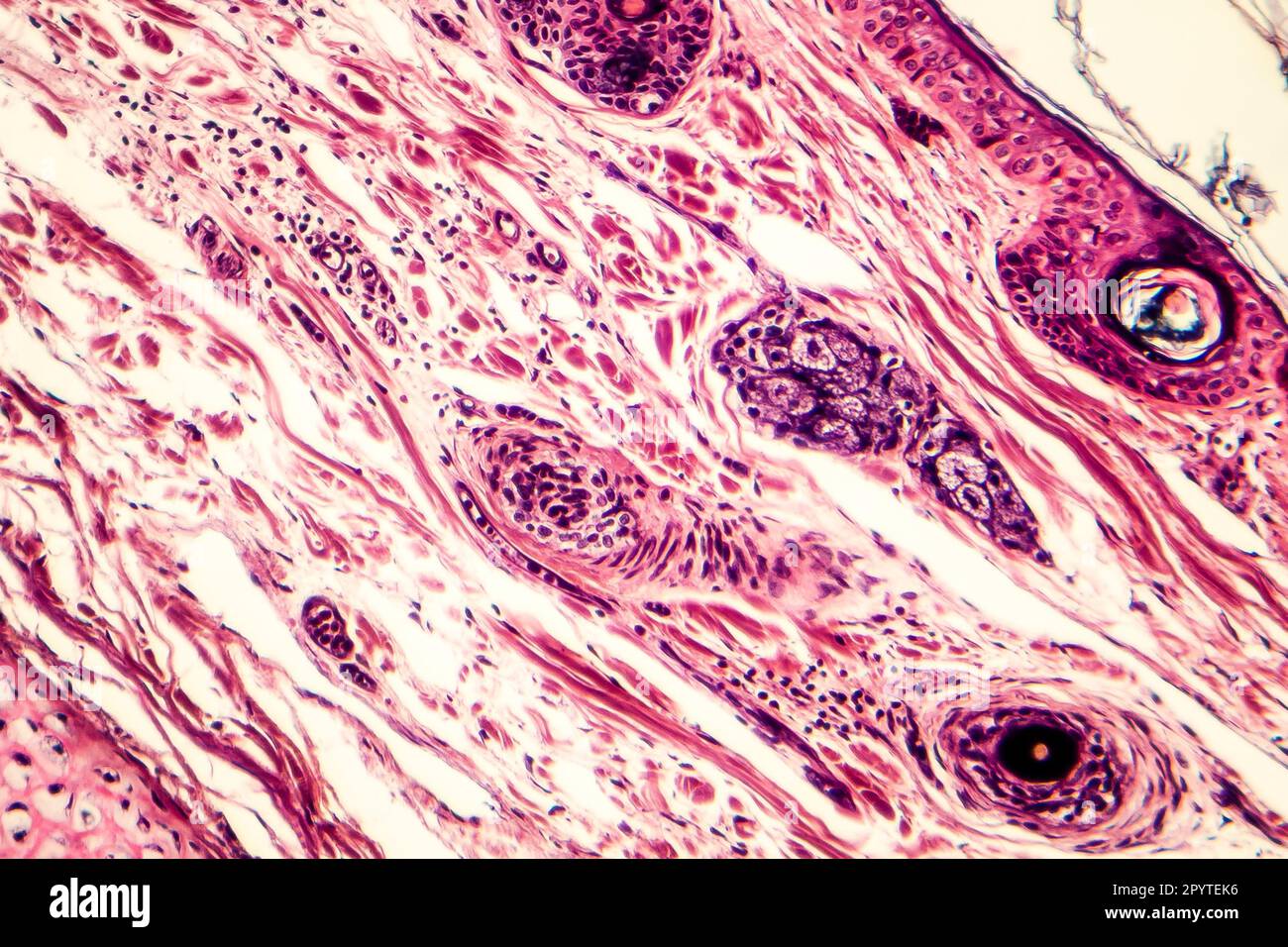Human Connective Tissue
