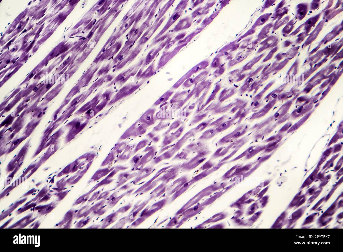 Human heart muscle, light micrograph. Striated cardiac muscle cells, or ...