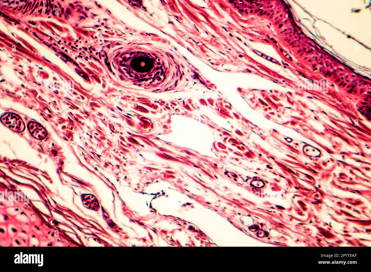 Connective tissue located at human outer ear, light micrograph ...