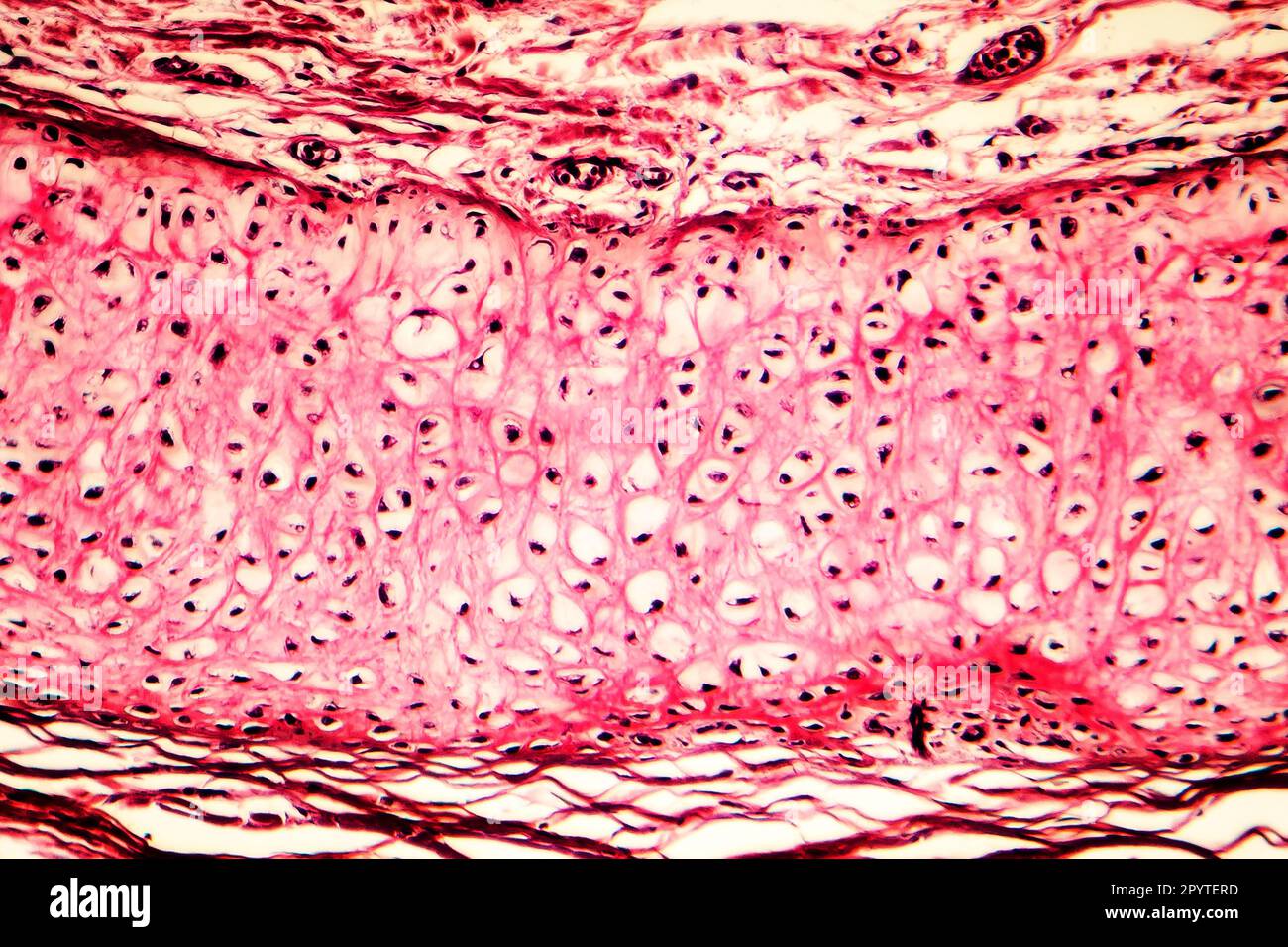 Ear Cartilage Histology