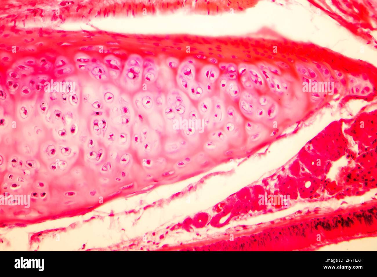 Hyaline cartilage of human trachea, light micrograph Stock Photo - Alamy