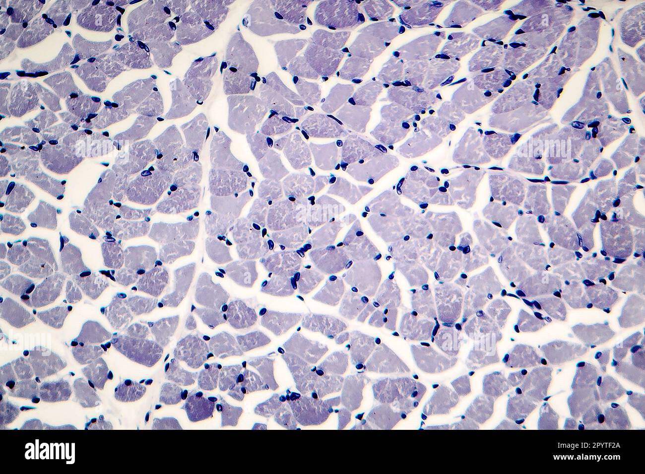 Human skeletal muscle, cross section, light micrograph Stock Photo - Alamy