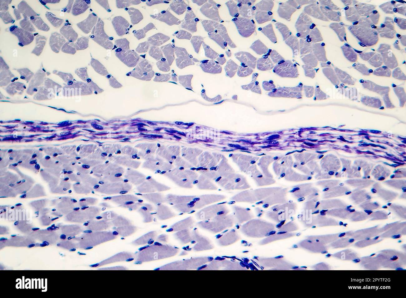 Human skeletal muscle, cross section, light micrograph Stock Photo - Alamy Human skeletal muscle, cross section, light micrograph Stock Photo - Alamy