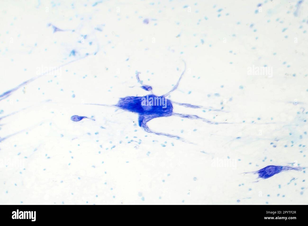 Light micrograph human cells hi-res stock photography and images - Alamy