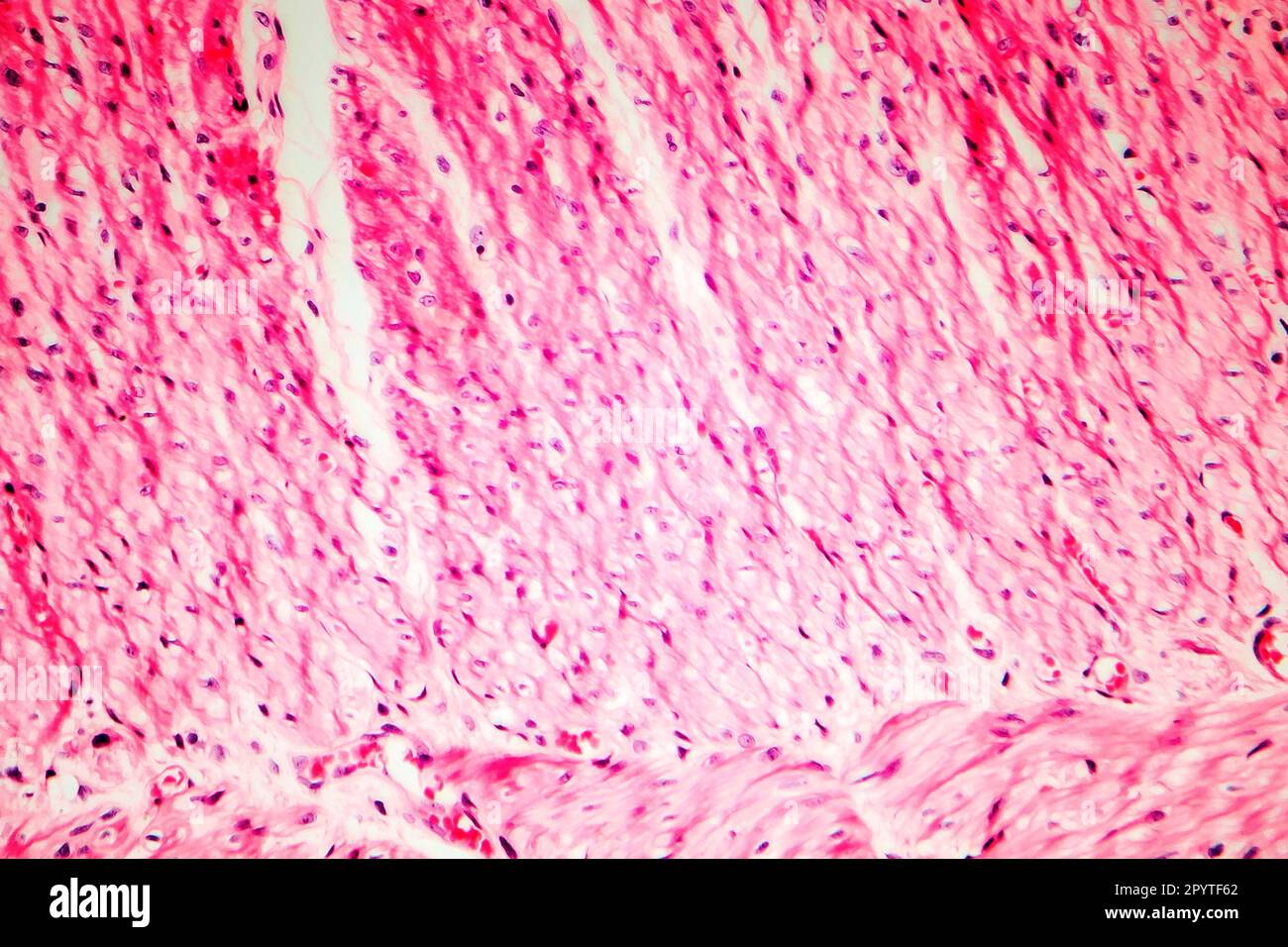Human smooth muscle, cross section, light micrograph Stock Photo - Alamy