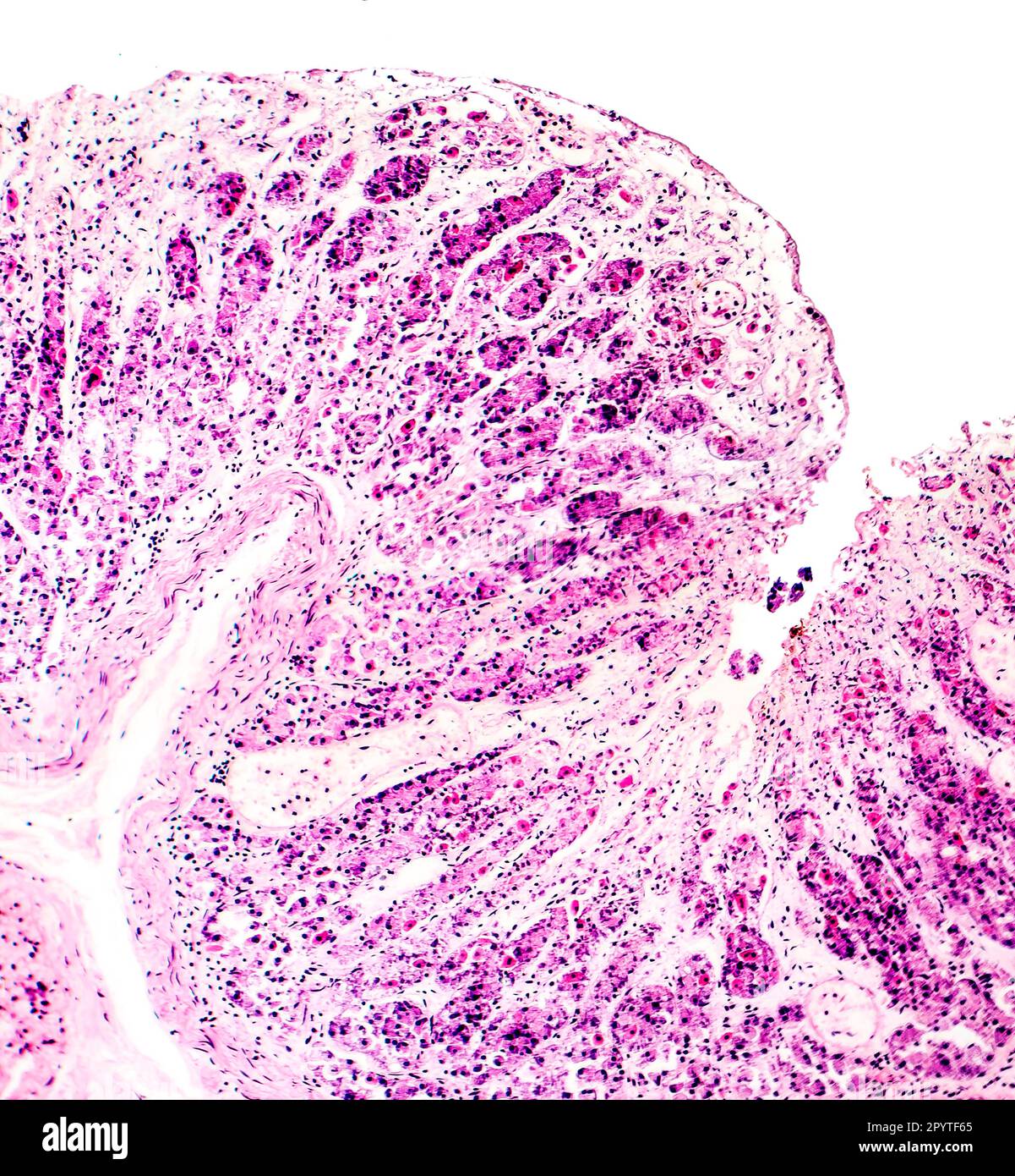 Cross section of human stomach. Light micrograph showing stomach ...