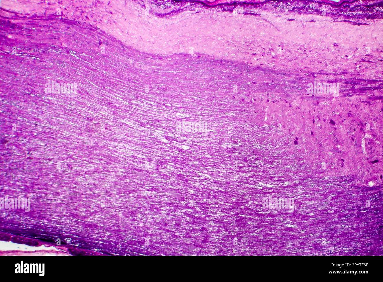 Human spinal cord, longitudinal section, light photomicrograph Stock ... Human spinal cord, longitudinal section, light photomicrograph Stock ...