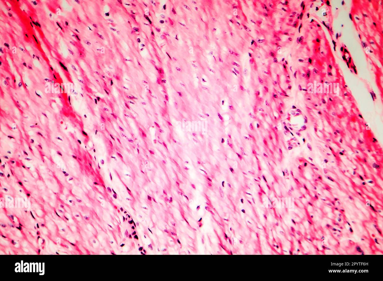 Smooth Muscle Cross Section