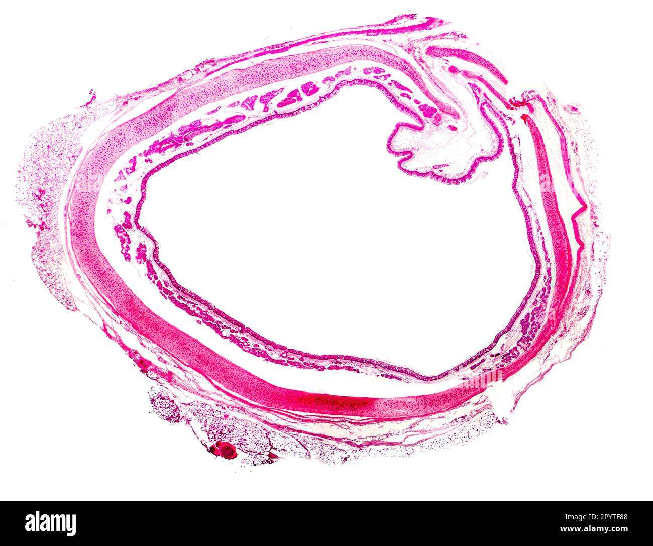 Esophagus And Trachea Cross Section