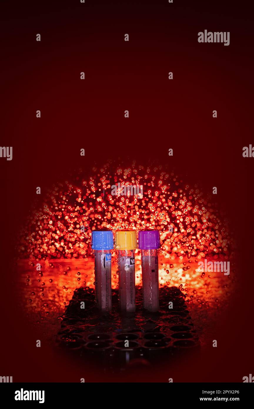 Phlebotomy tubes for venipuncture (venepuncture) blood samples with ...