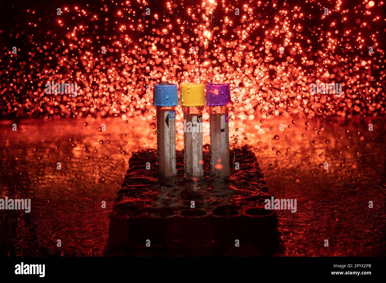 Phlebotomy tubes for venipuncture (venepuncture) blood samples with ...