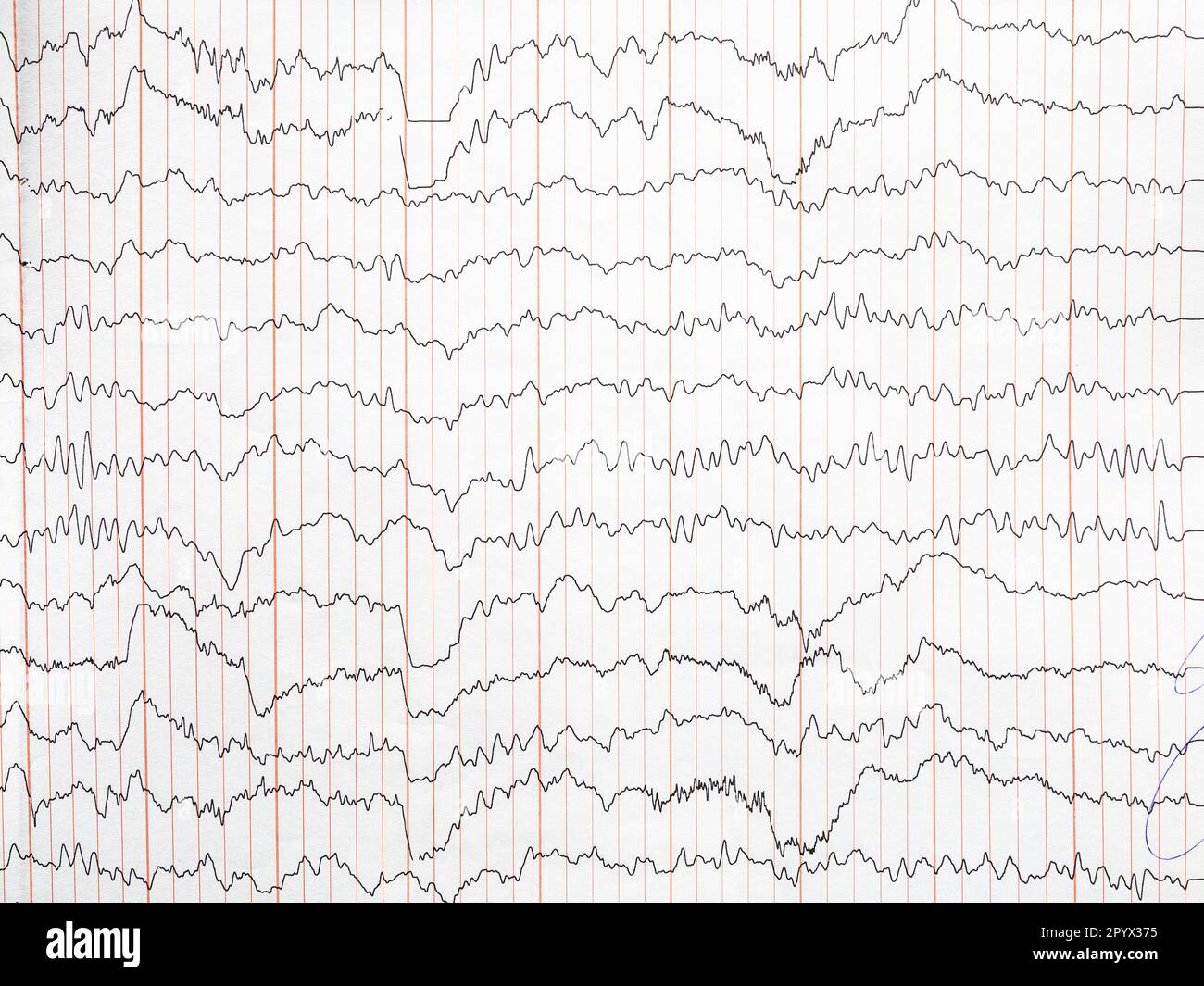 encephalogram on paper - trace of electrical activity of human brain ...