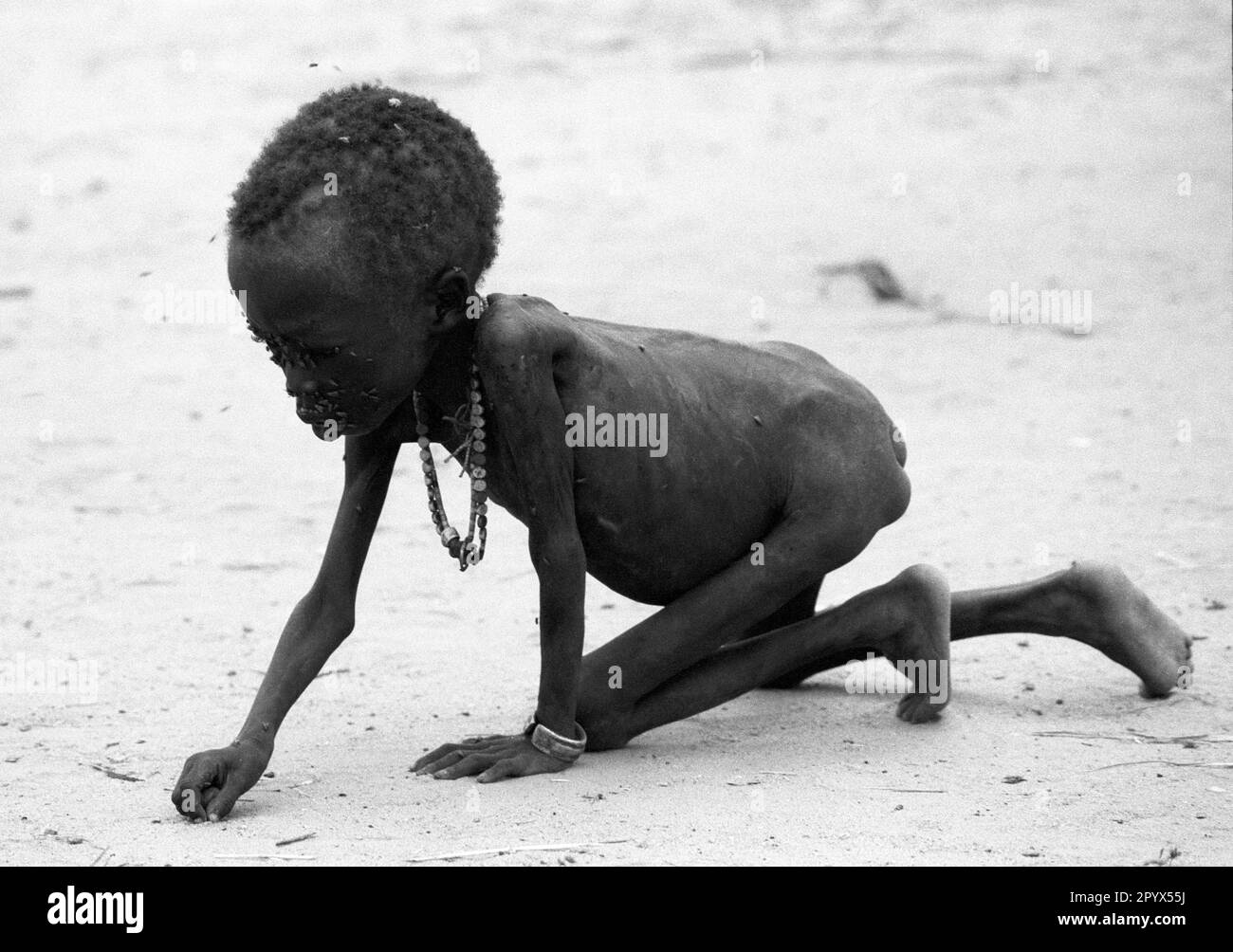 Malnourished sudan hi-res stock photography and images - Alamy