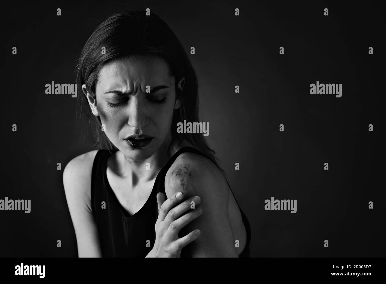 Woman with facial injuries on black background, space for text ...