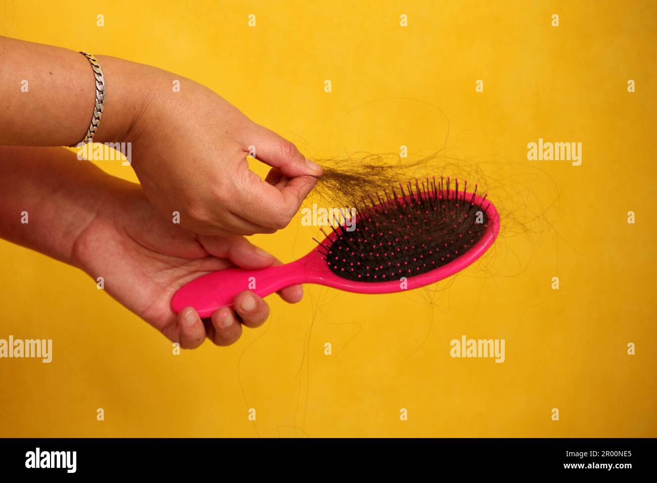 Woman's hands take a hairbrush with many fallen hairs after brushing ...