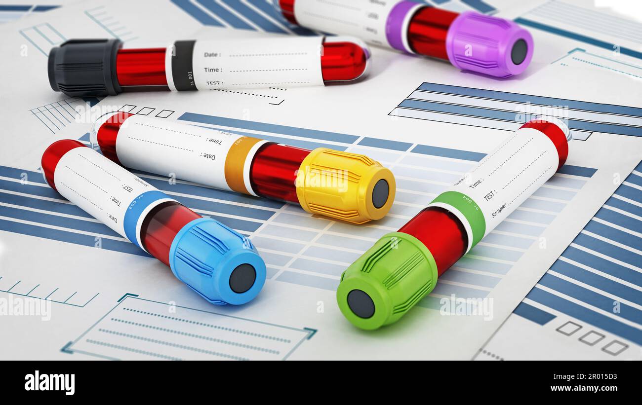 Blood vials with vibrant colored lids standing on medical forms. 3D ...