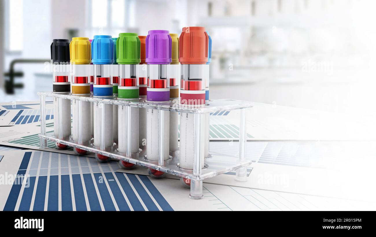 Blood vials with vibrant colored lids standing on medical forms. 3D ...
