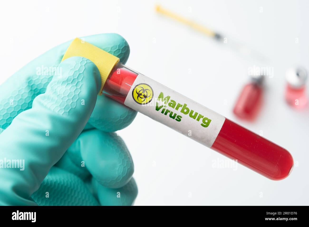 Marburg virus patient hi-res stock photography and images - Alamy