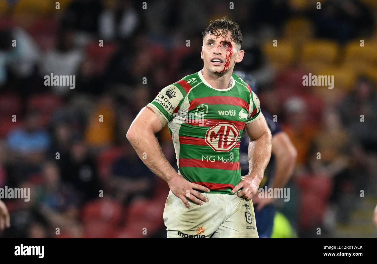 Cameron Murray of the Rabbitohs is seen bleeding from an injury during ...