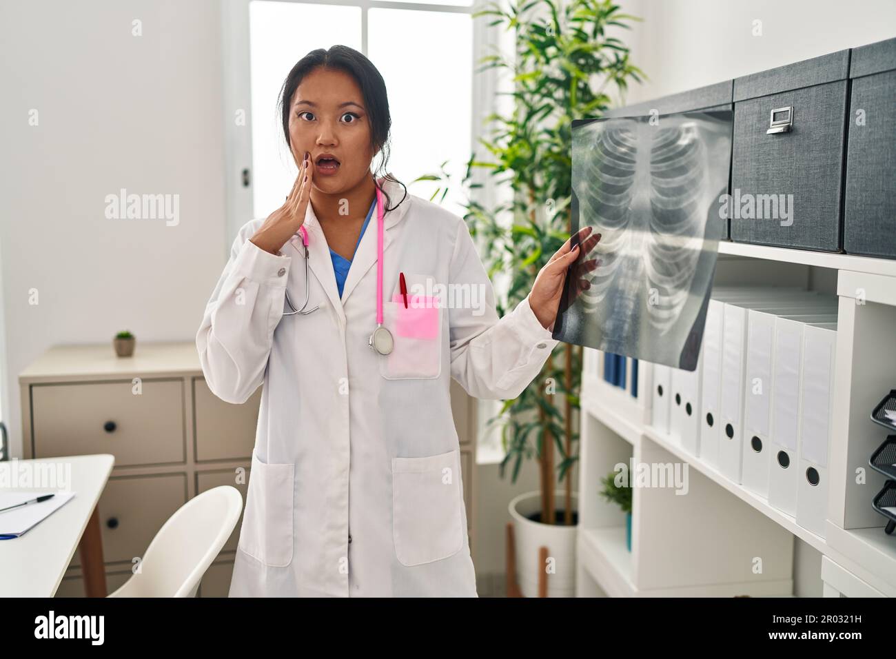 Young asian doctor woman holding chest x-ray scared and amazed with ...