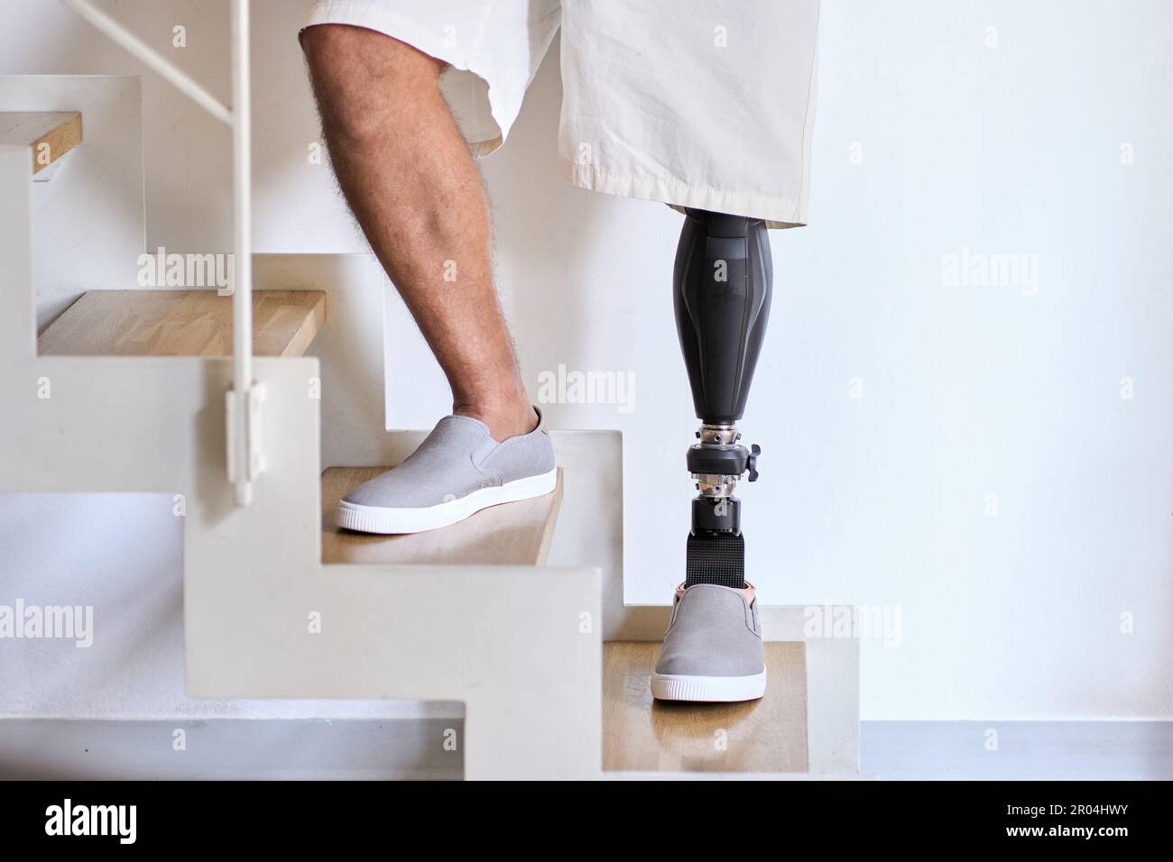 Amputee man with above knee leg prosthesis standing on feet, close up ...