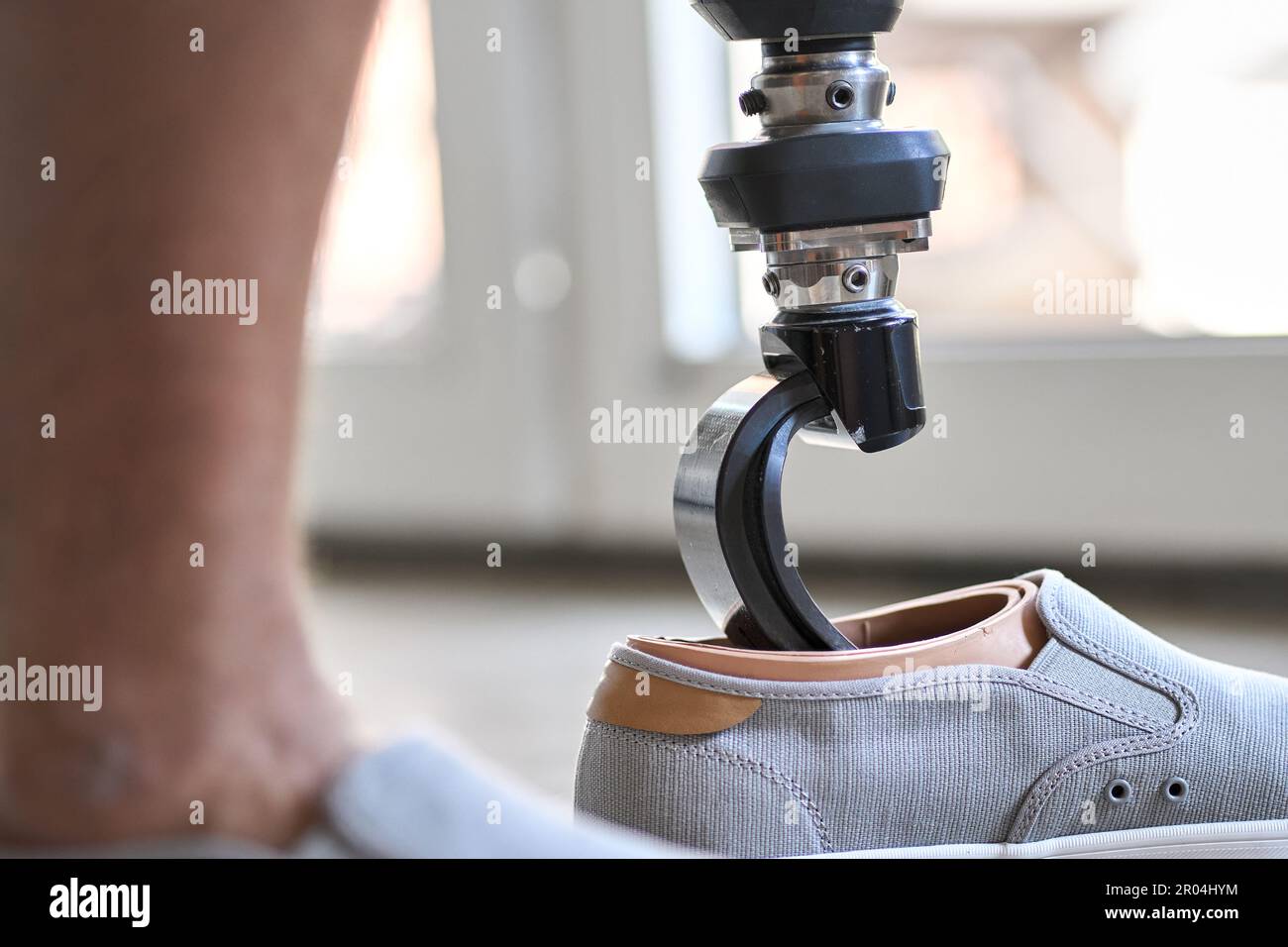 Above knee amputee medical hi-res stock photography and images - Alamy