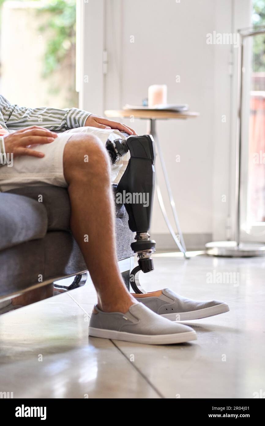 Above the knee prosthesis hi-res stock photography and images - Alamy