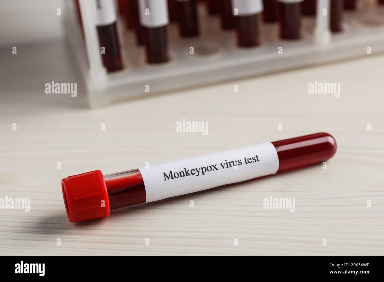 Blood sample tube monkeypox hi-res stock photography and images - Alamy
