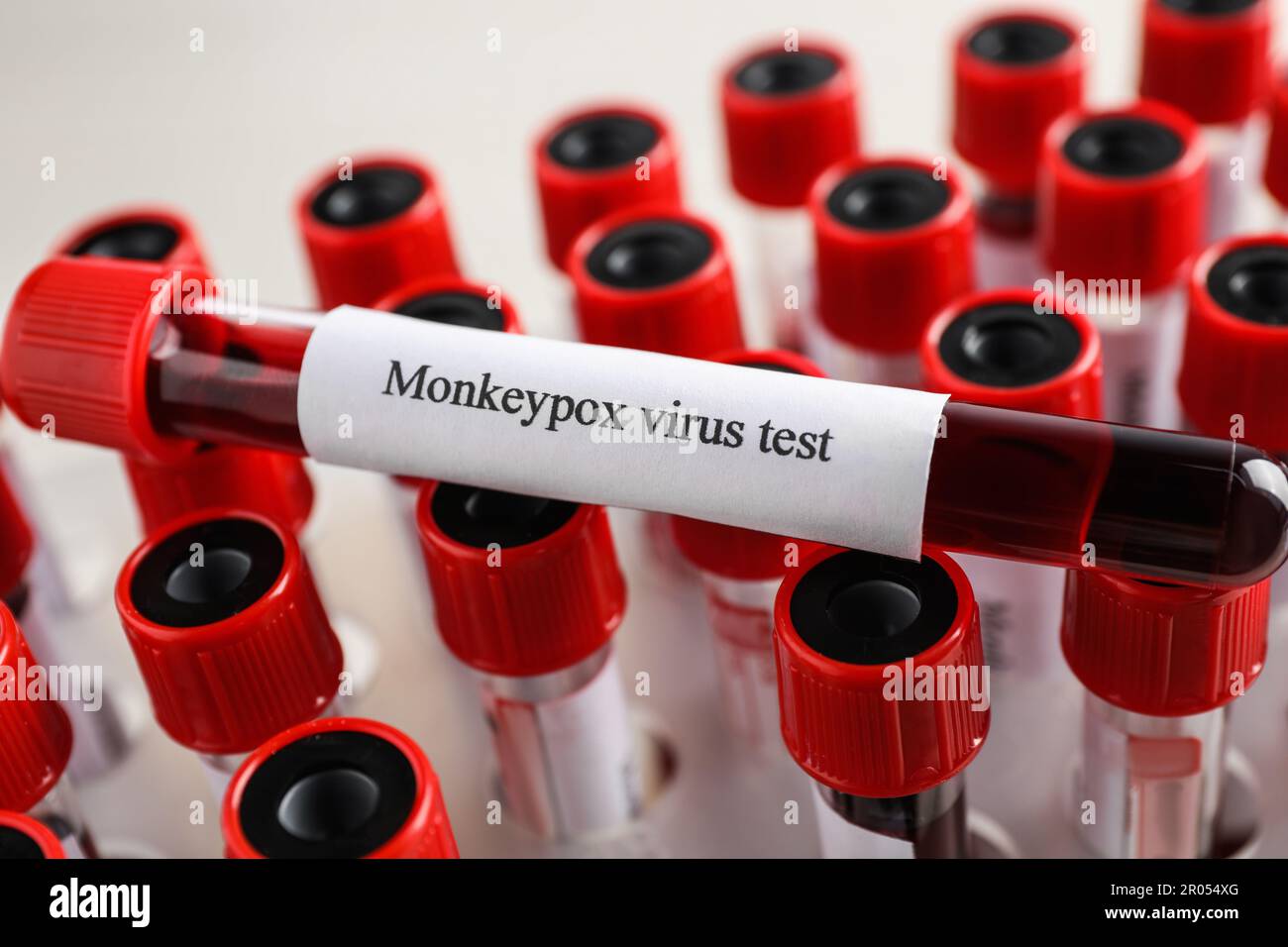 Monkeypox virus test. One sample tube with blood on others, closeup ...