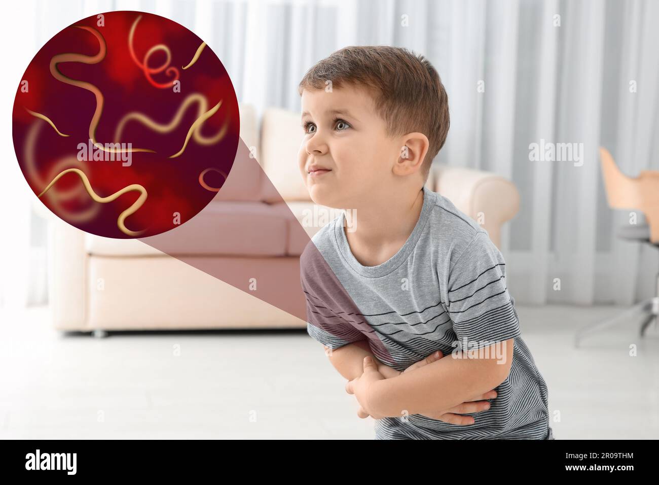 Parasites under microscope and boy suffering from helminthiasis Stock ...