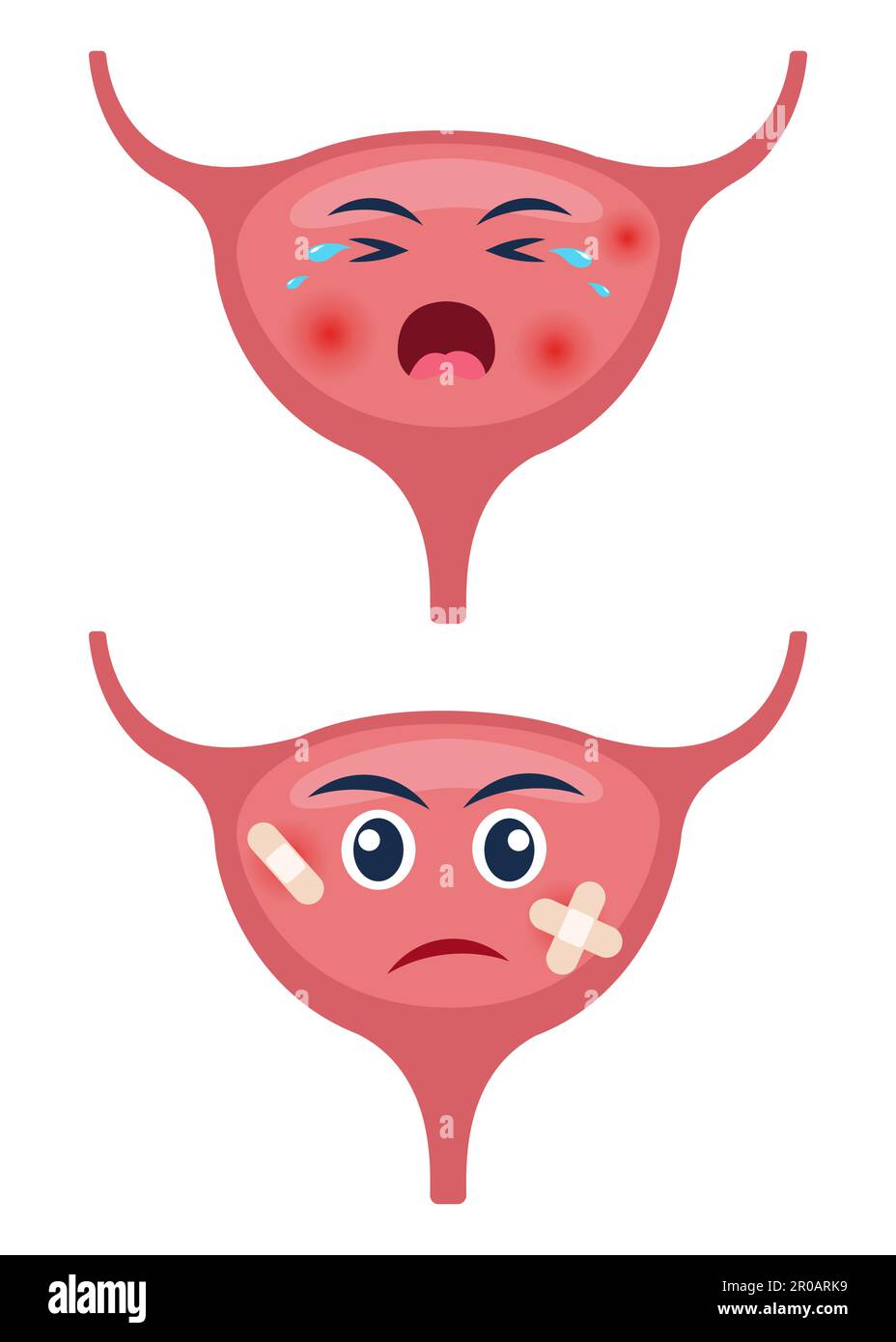 Sick bladder with pain ache or disease. Sad cartoon character bladder ...