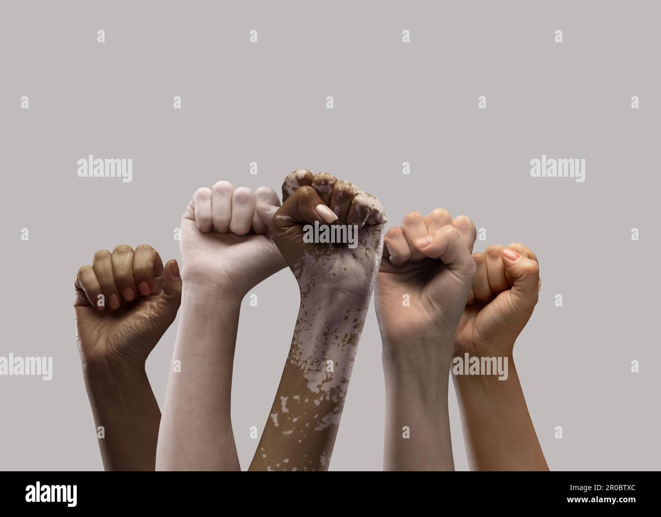 Hands of different people, of diverse race, skin color, gender raising ...