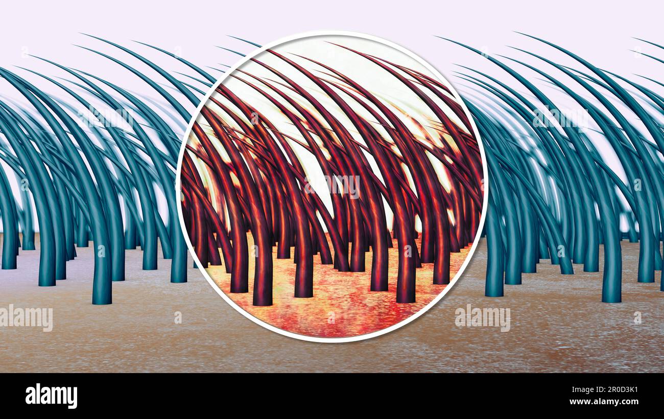 Surface of the skin, hair, hair health, trichology, fat, dandruff of ...