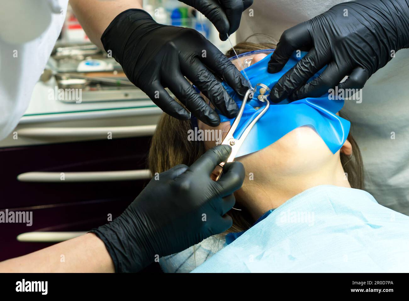 Doctor and help assistant isolate patient's teeth with rubber pad ...