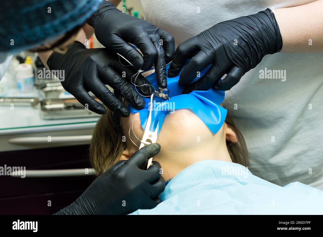 Doctor and help assistant isolate patient's teeth with rubber pad ...
