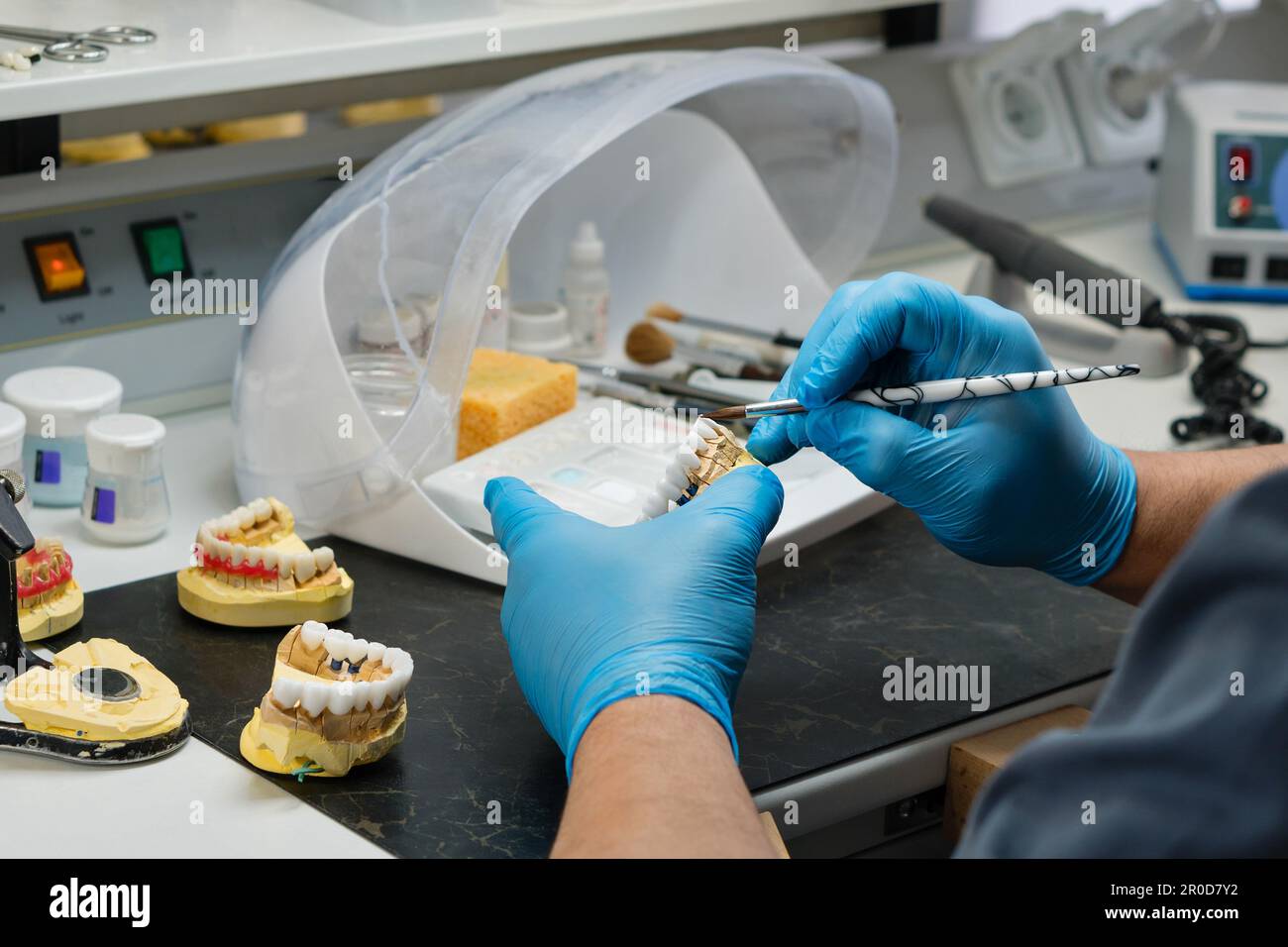 Dental prosthesis work. Denture work. Teeth painting. Dental technician ...