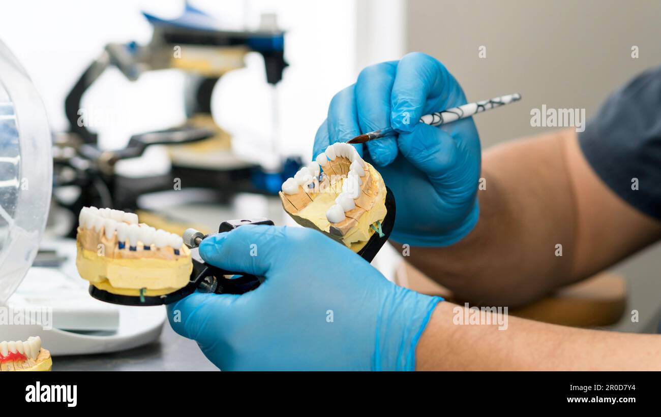 Dental prosthesis work. Denture work. Teeth painting. Dental technician ...