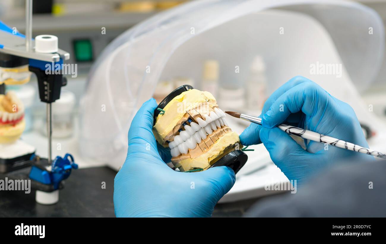 Dental prosthesis work. Denture work. Teeth painting. Dental technician ...