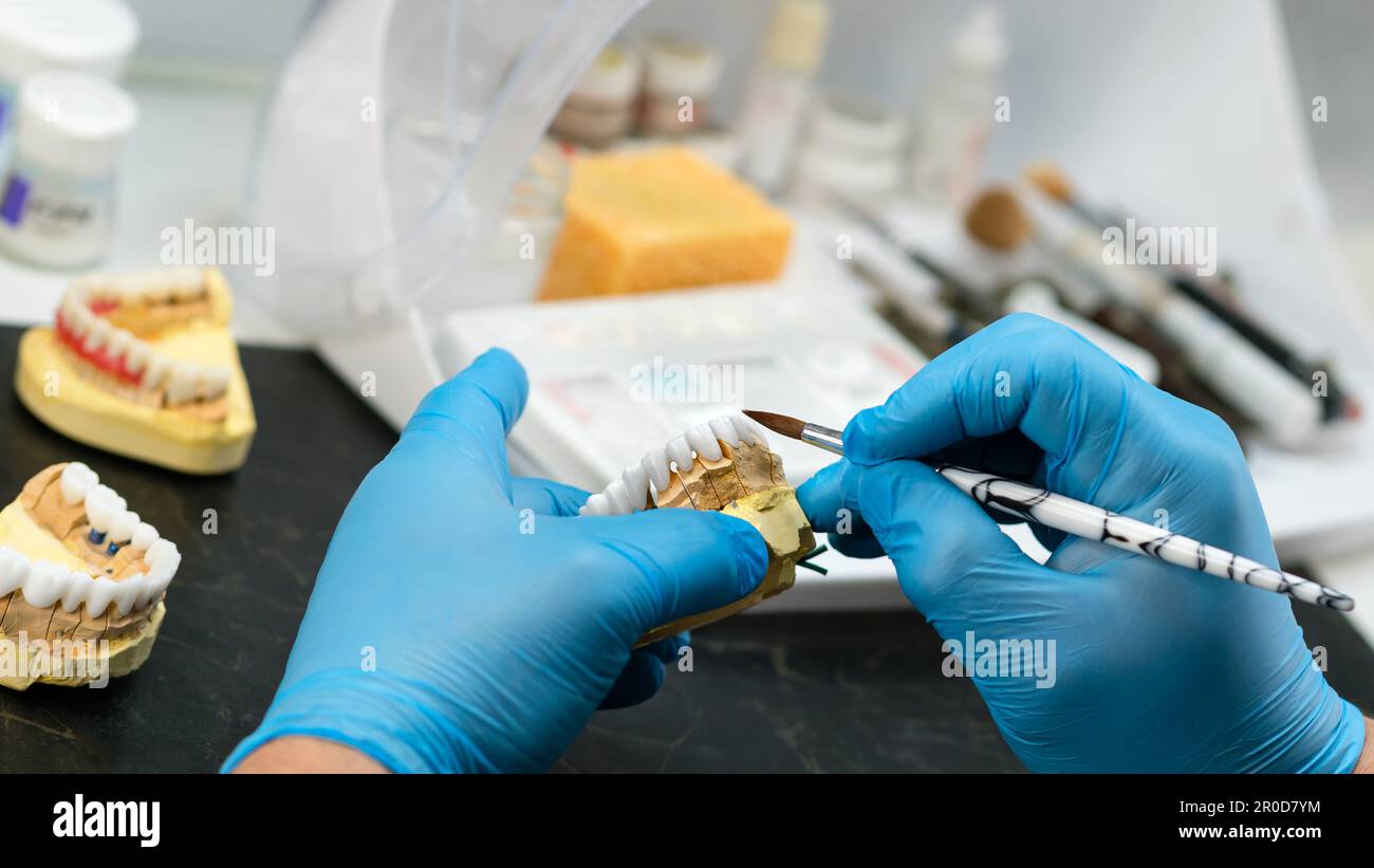 Dental prosthesis work. Denture work. Teeth painting. Dental technician ...