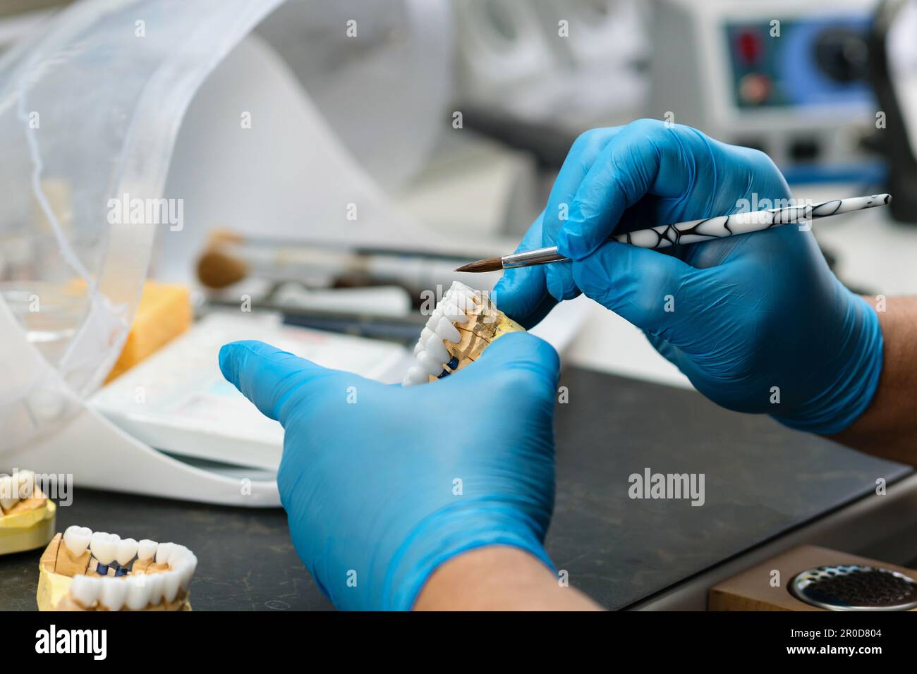 Dental prosthesis work. Denture work. Teeth painting. Dental technician ...