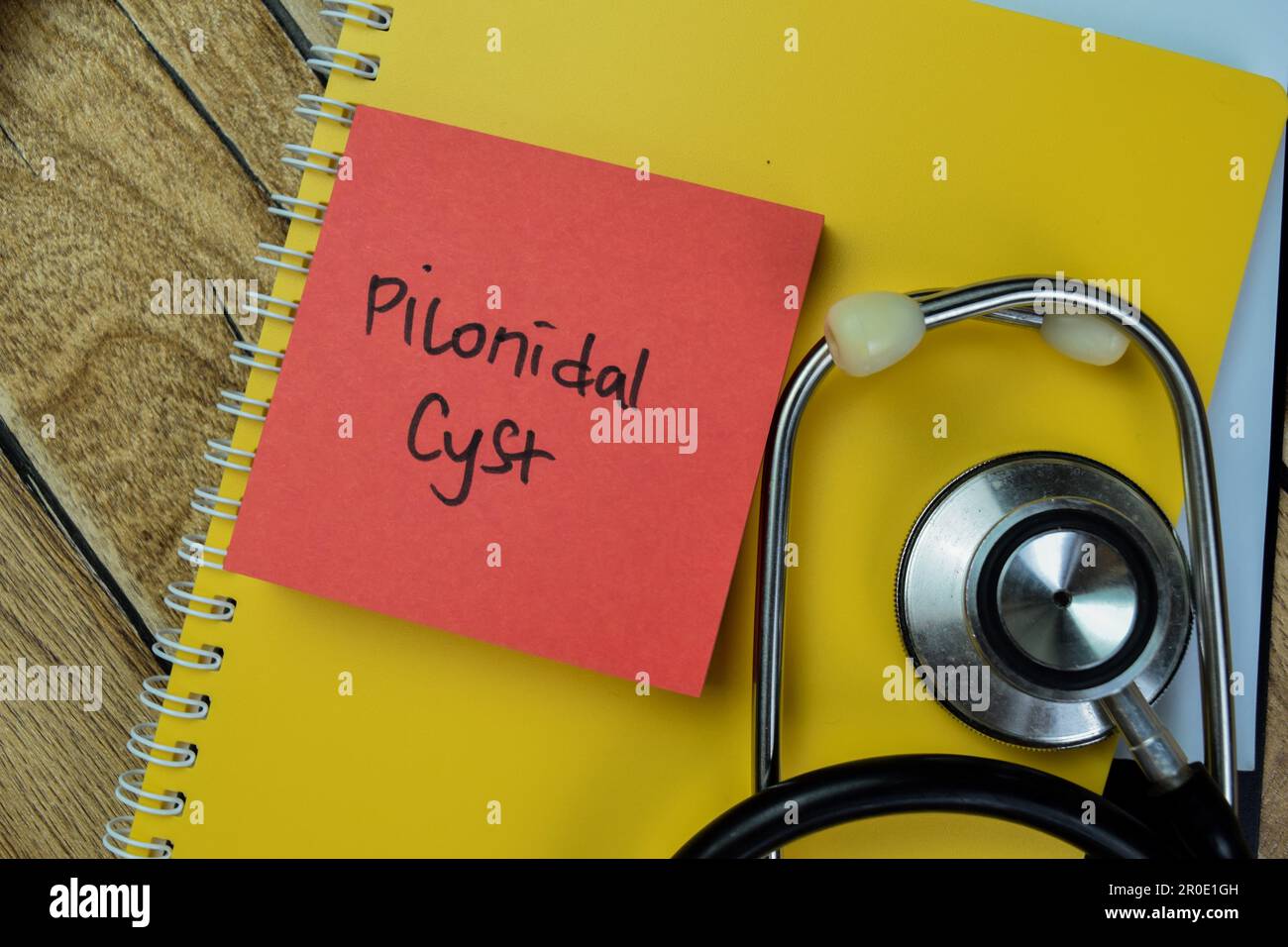 Concept Of Pilonidal Cyst Write On Sticky Notes With Stethoscope
