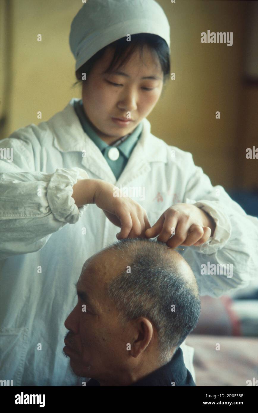 Akupunktur acupuncture hi-res stock photography and images - Alamy