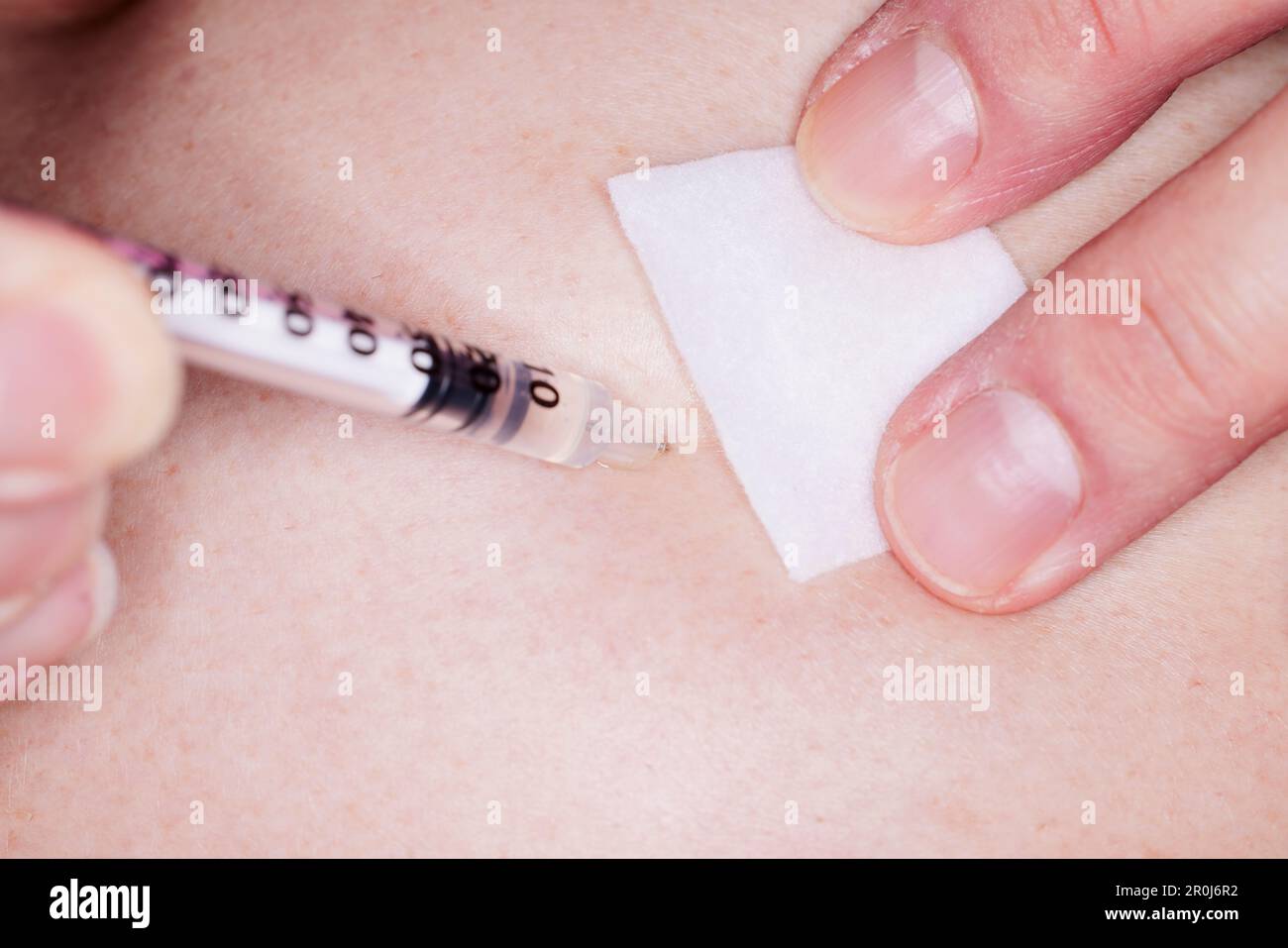 Close up of preparing to remove needle and syringe filled with ...